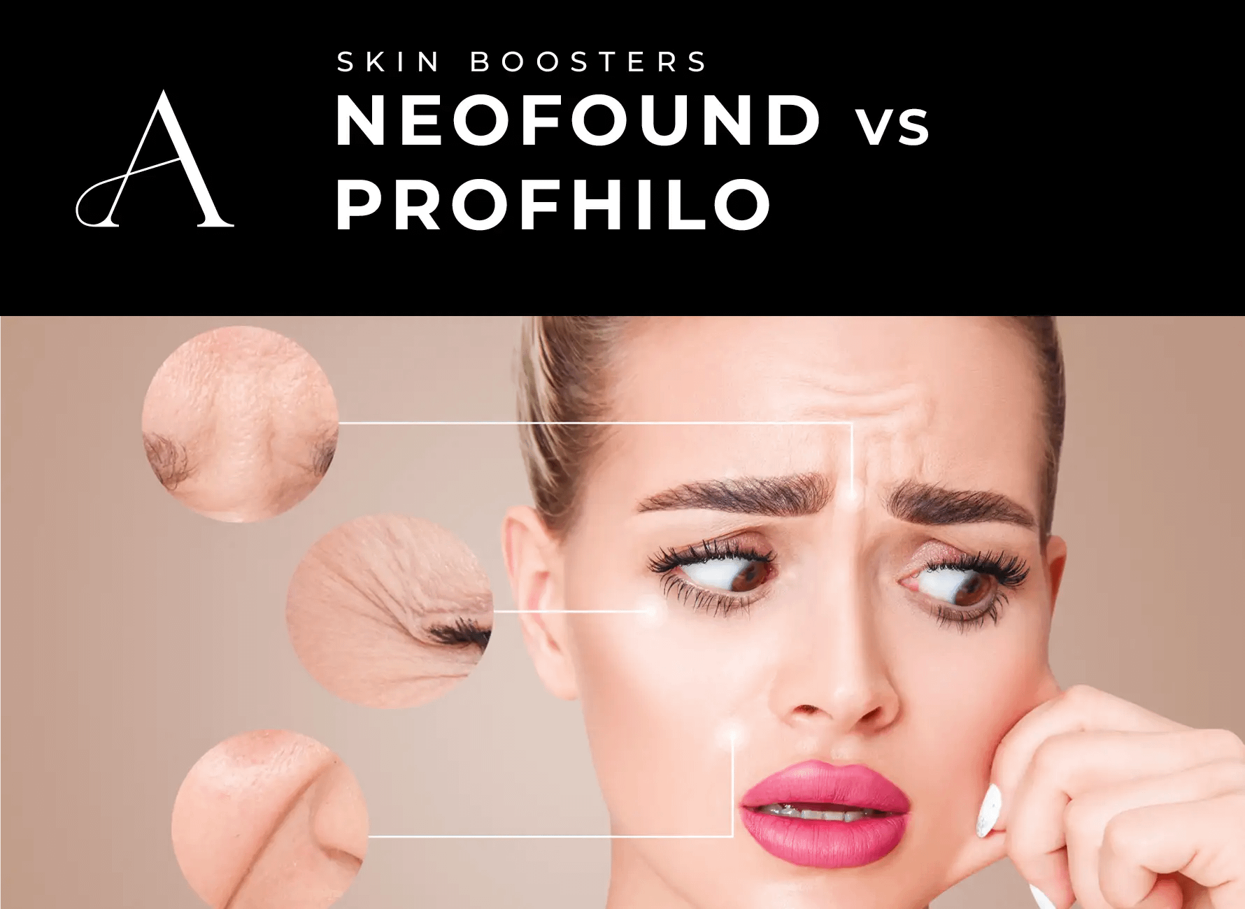 Revitalising Your Skin: Neofound Vs Profhilo - The Ultimate Showdown ...